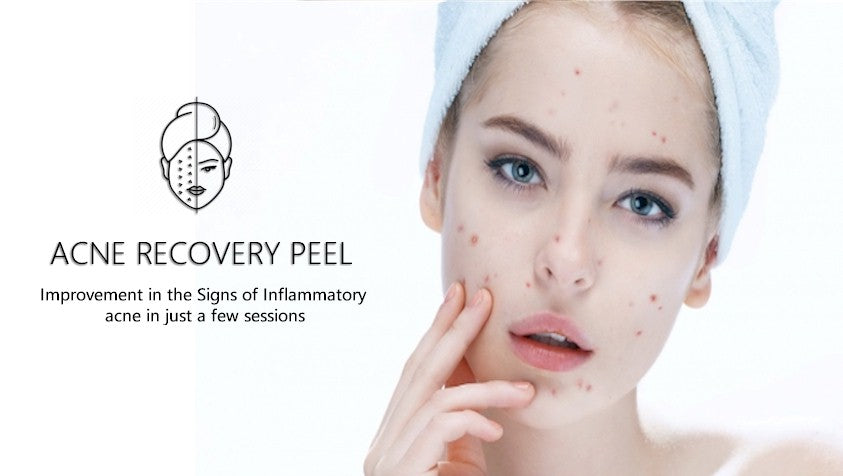 Acne Recovery Peel – Enhanze Online